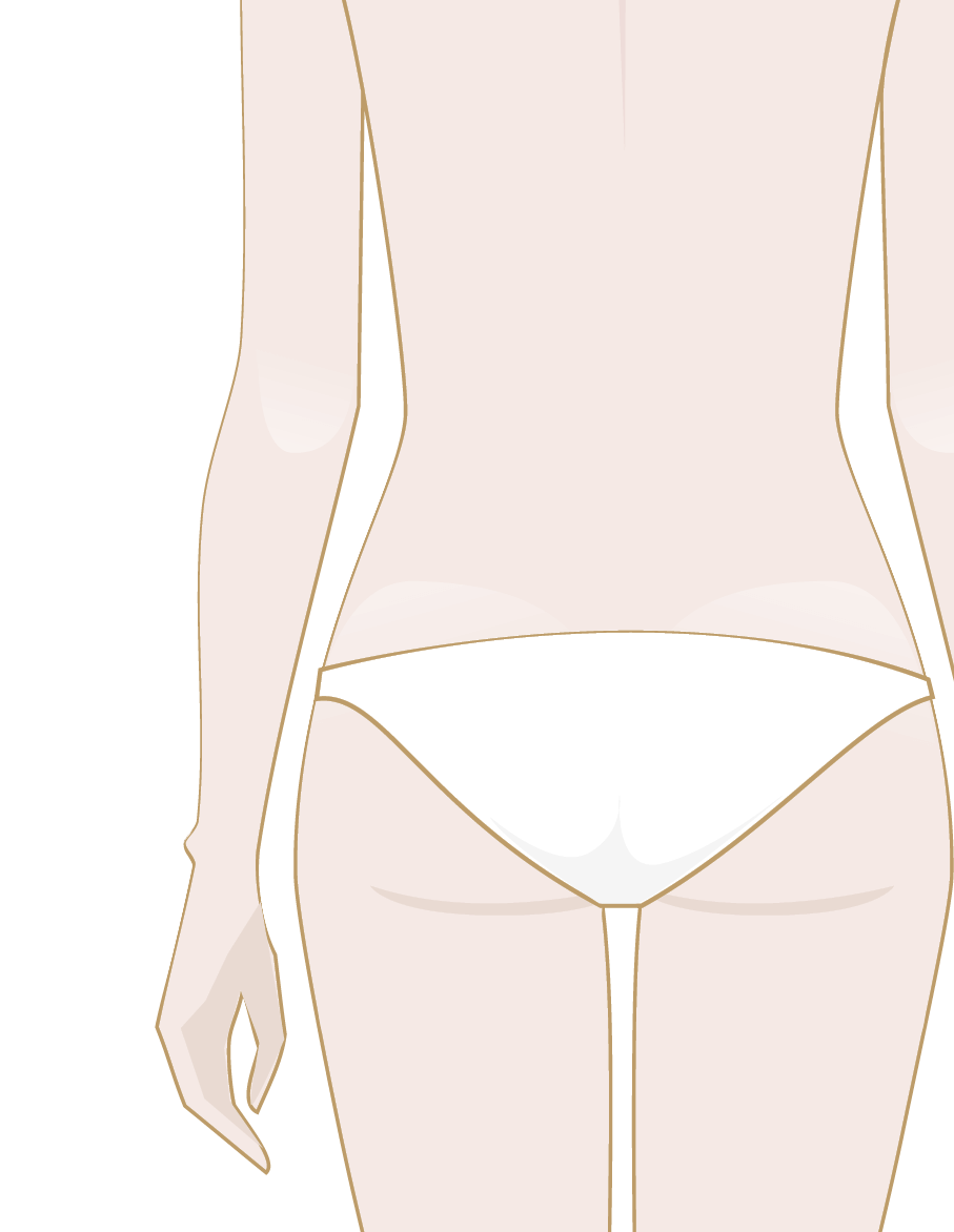 Des Vergetures Sur Les Fesses Comment Les Rendre Moins Visibles